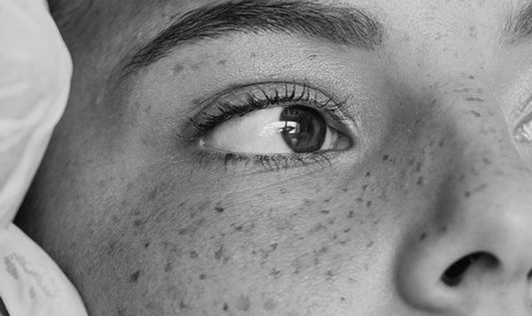 Facial Aesthetics Cape Town | Anti-Wrinkle, Fillers And More